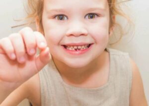 When Should Child Start Losing Teeth? Key Milestones and What to Expect ...